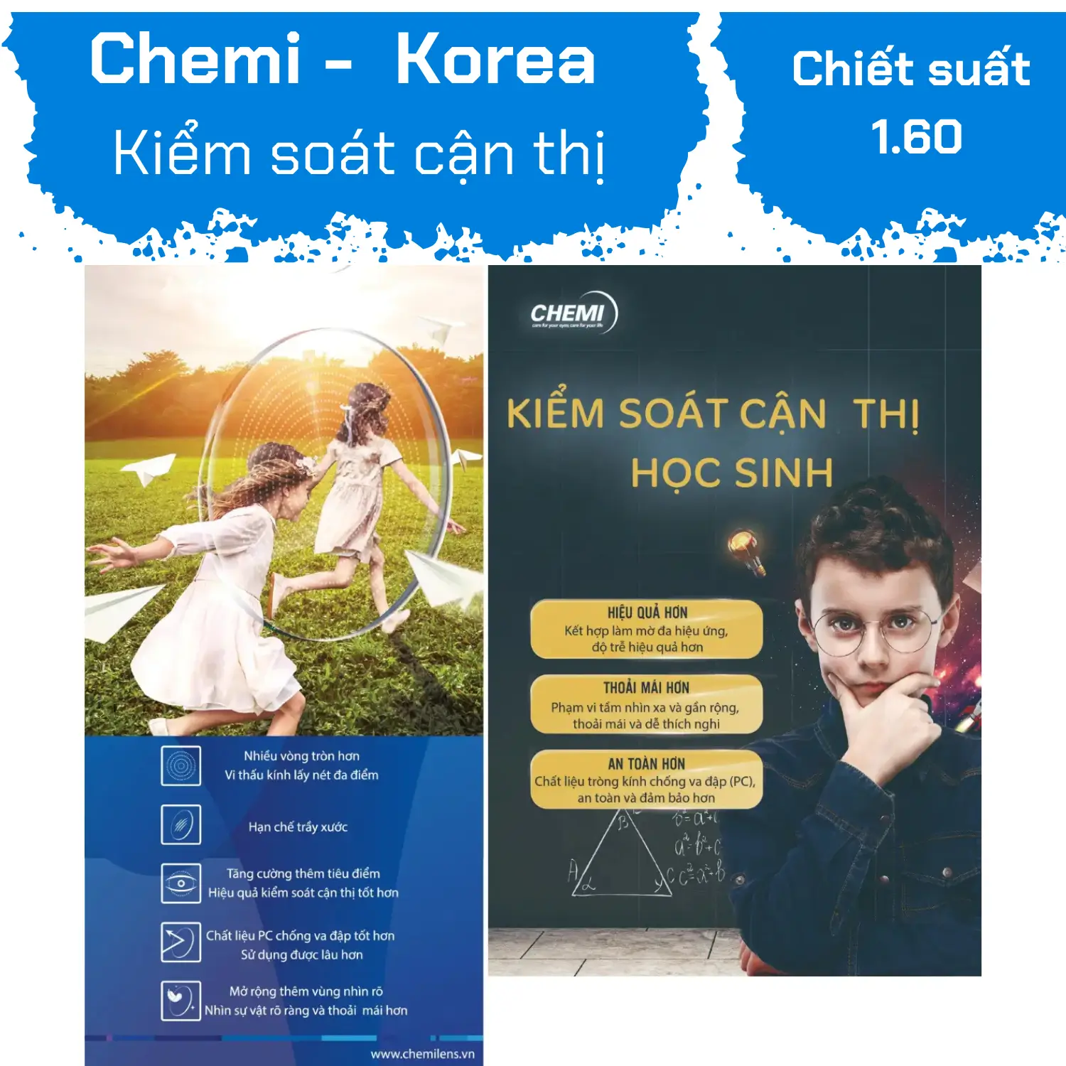 Tròng Kiểm Soát Cận Thị Học Sinh – Chemi Myopia Control Lens - Kính Mắt ...
